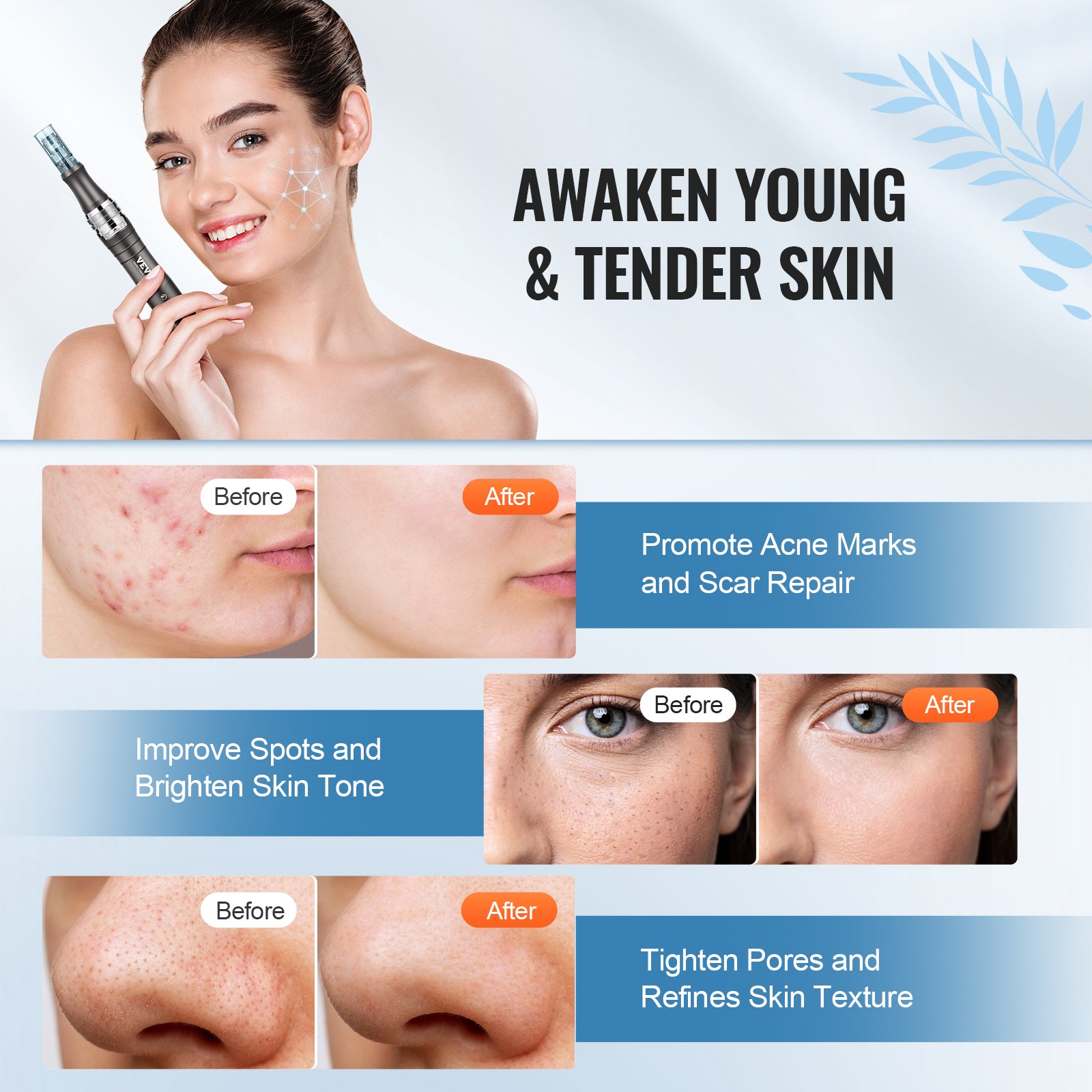 VEVOR Electric Microneedle Derma Pen – 22 PCS, 0 - 2.5 mm